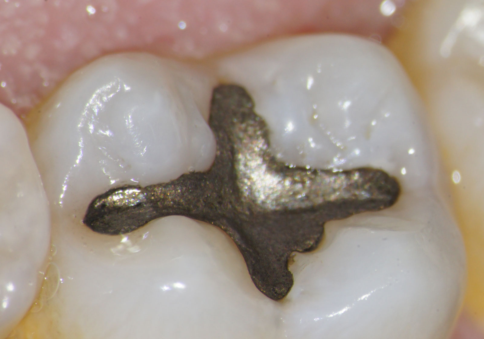 ENDOTOP | Tu Clinica Dental en Benidorm